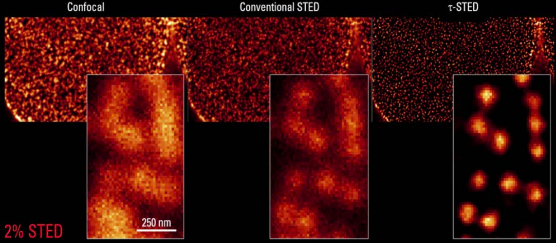 Super-resolution optical microscopy with STELLARIS 8 τ-STED | UniGe ...